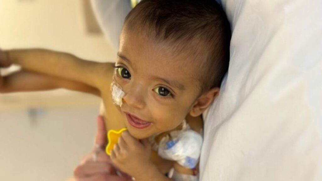 Sentido adiós a Camilo, el bebé trasplantado atresia biliar